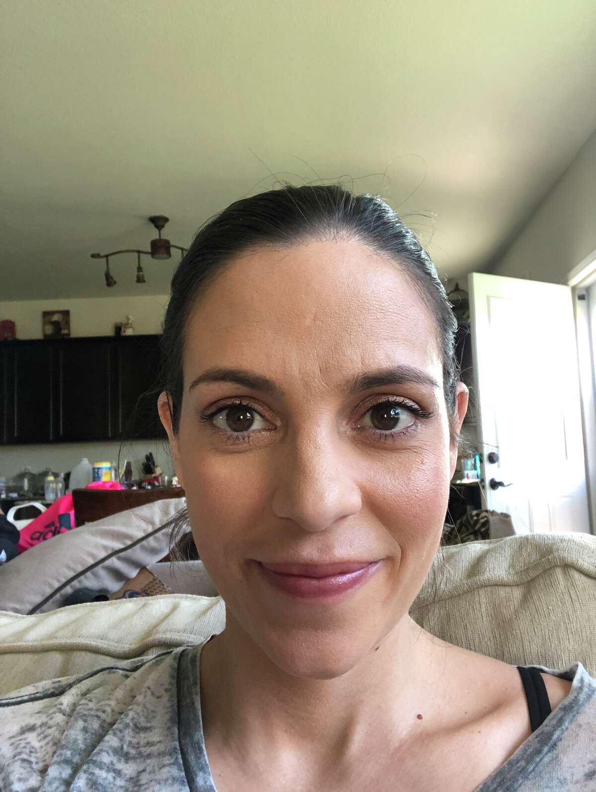 Meghan Markle makeover: Houston doctor gives two women plastic surgery ...