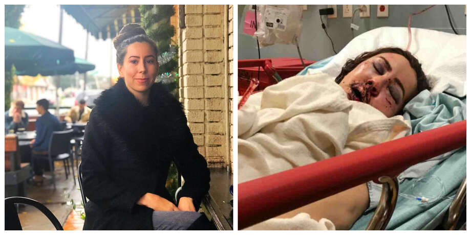 Houston plastic surgeon helps woman 'deformed' by assault - Houston ...