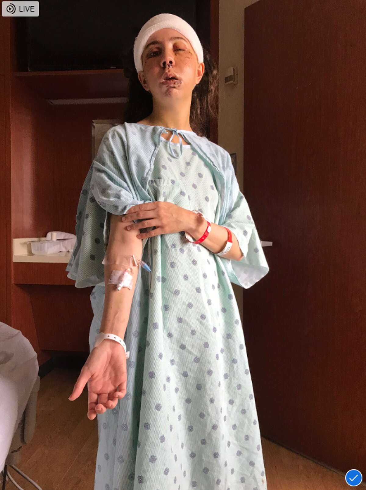 Man who allegedly 'destroyed' woman's face has criminal history in ...