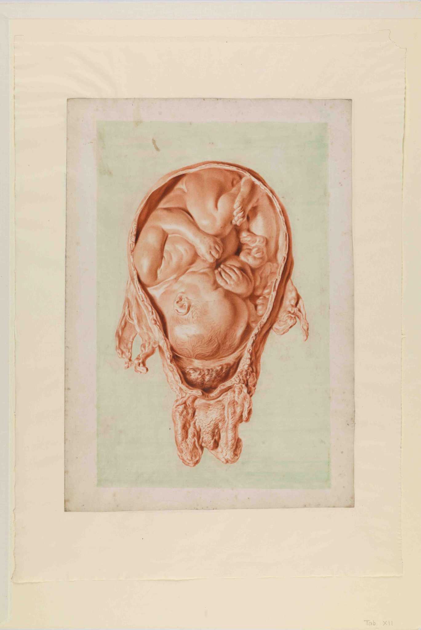 Collection of early ob-gyn Hunter in graphic exhibit at Yale Center for ...