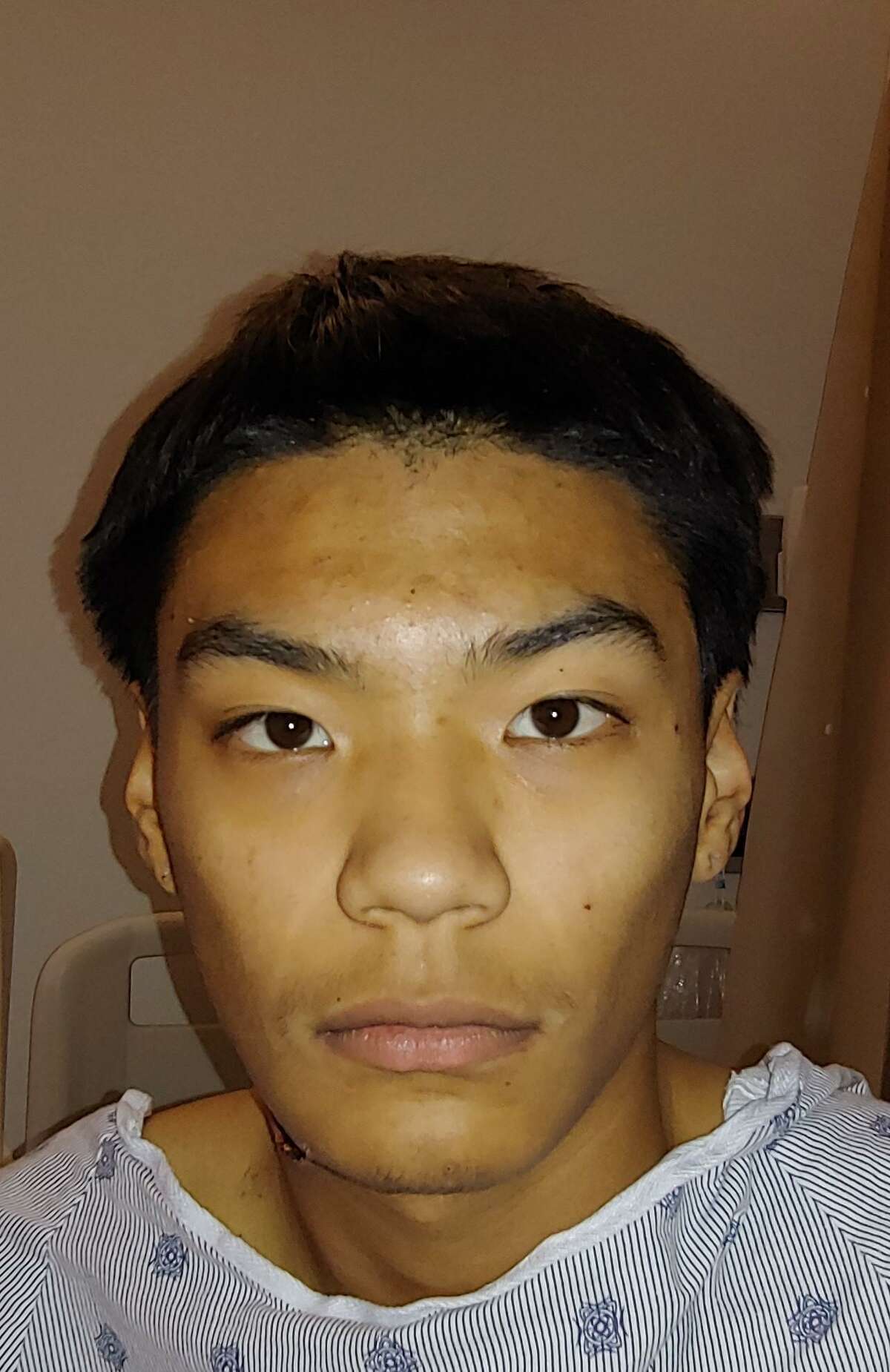 Suspect in ambush shooting faces attempted capital murder of a police ...