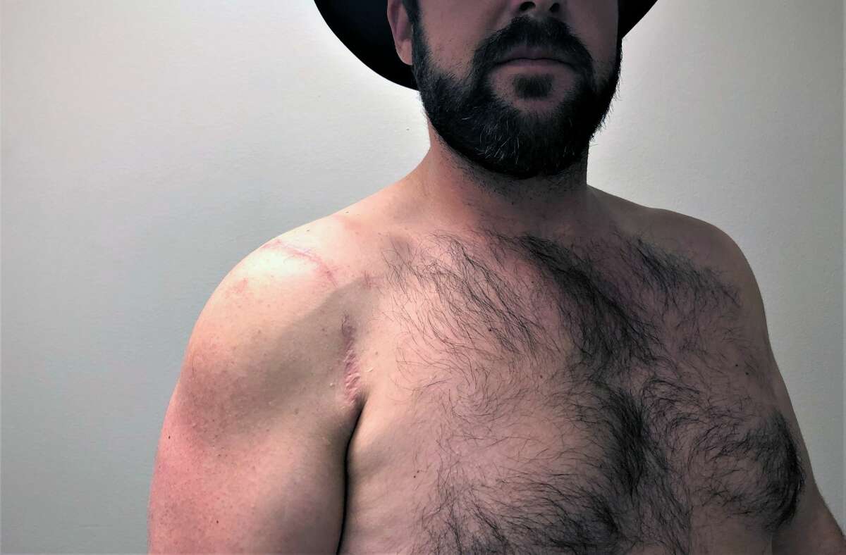 We asked rodeo cowboys to show us their scars. Here's what we saw
