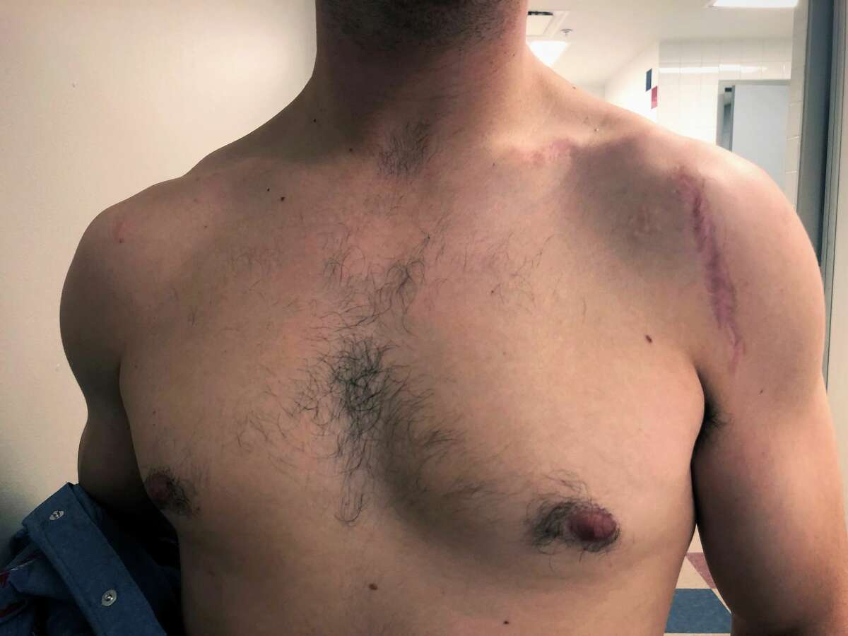 We asked rodeo cowboys to show us their scars. Here's what we saw