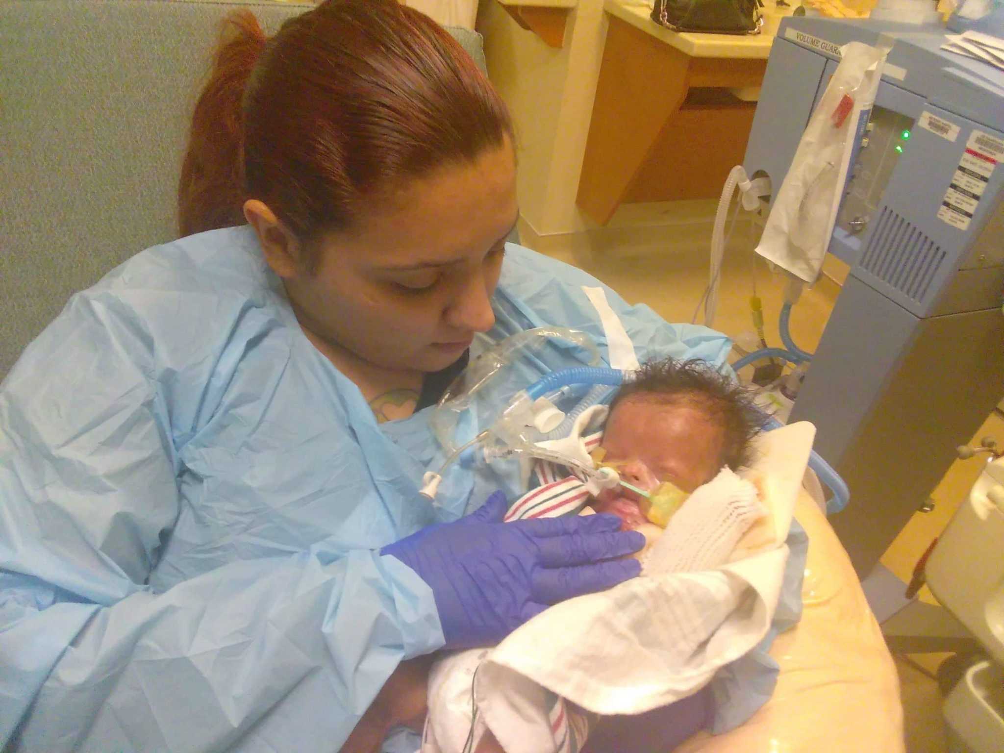 Baby born without skin in San Antonio in stable condition — but not out ...