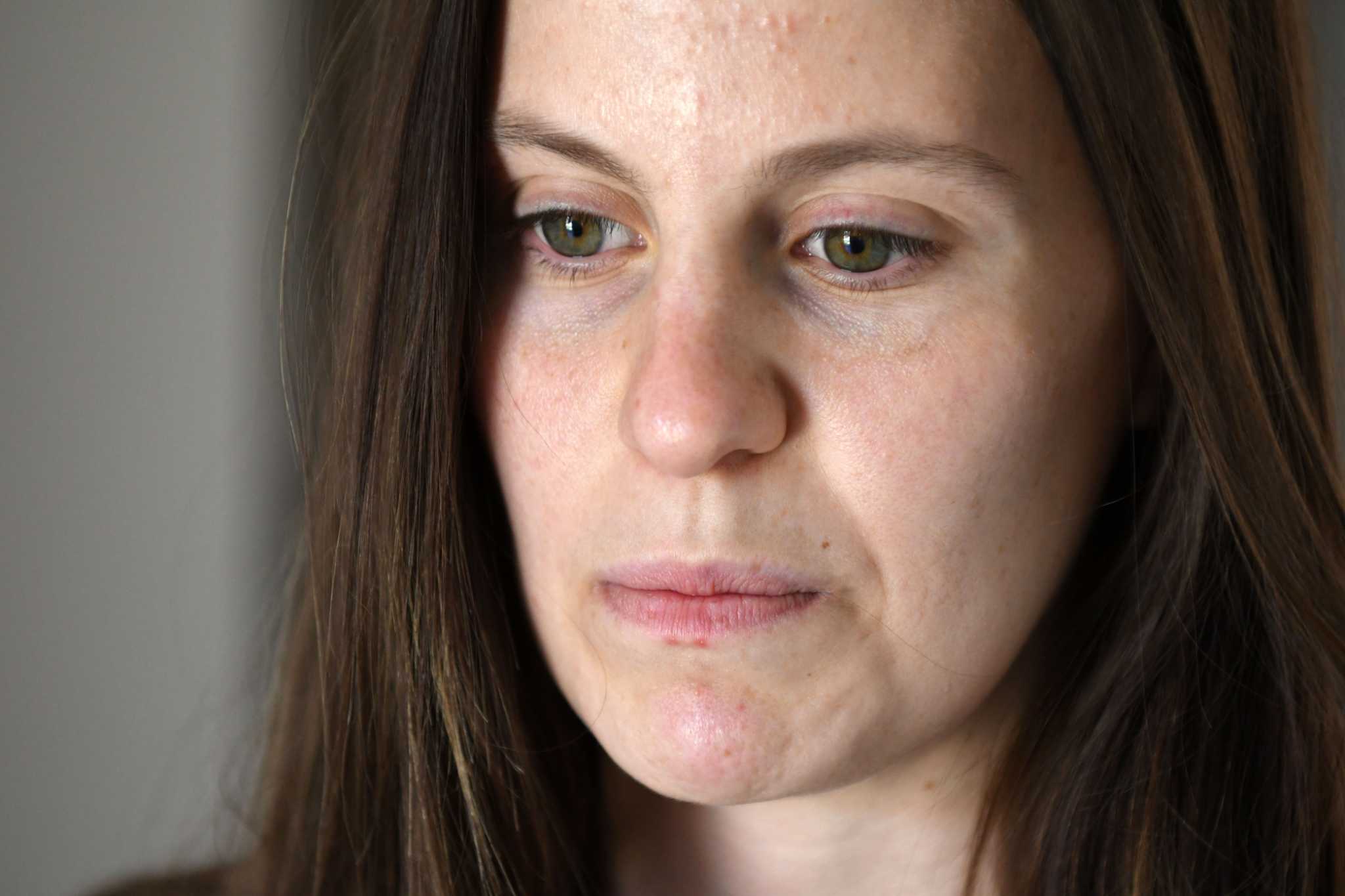 Albany woman has one of the world's most painful conditions