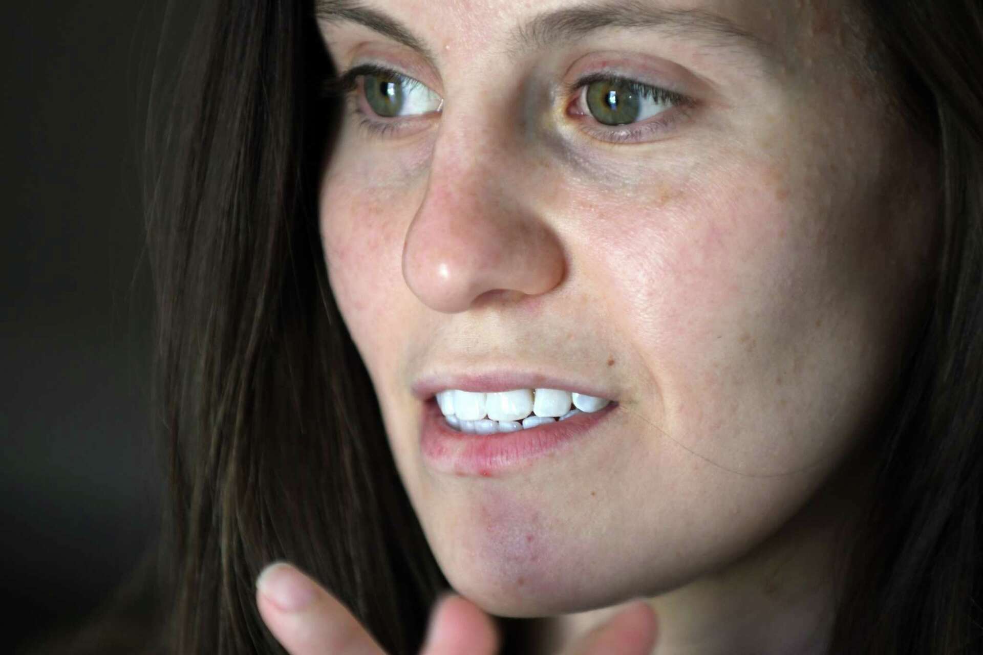 Albany woman has one of the world's most painful conditions