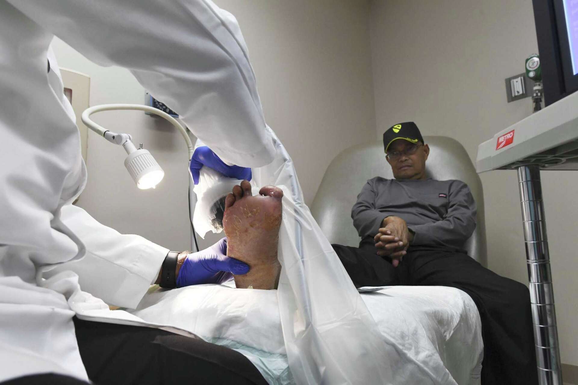 New shockwave treatment heals diabetic foot wounds of San Antonio patients