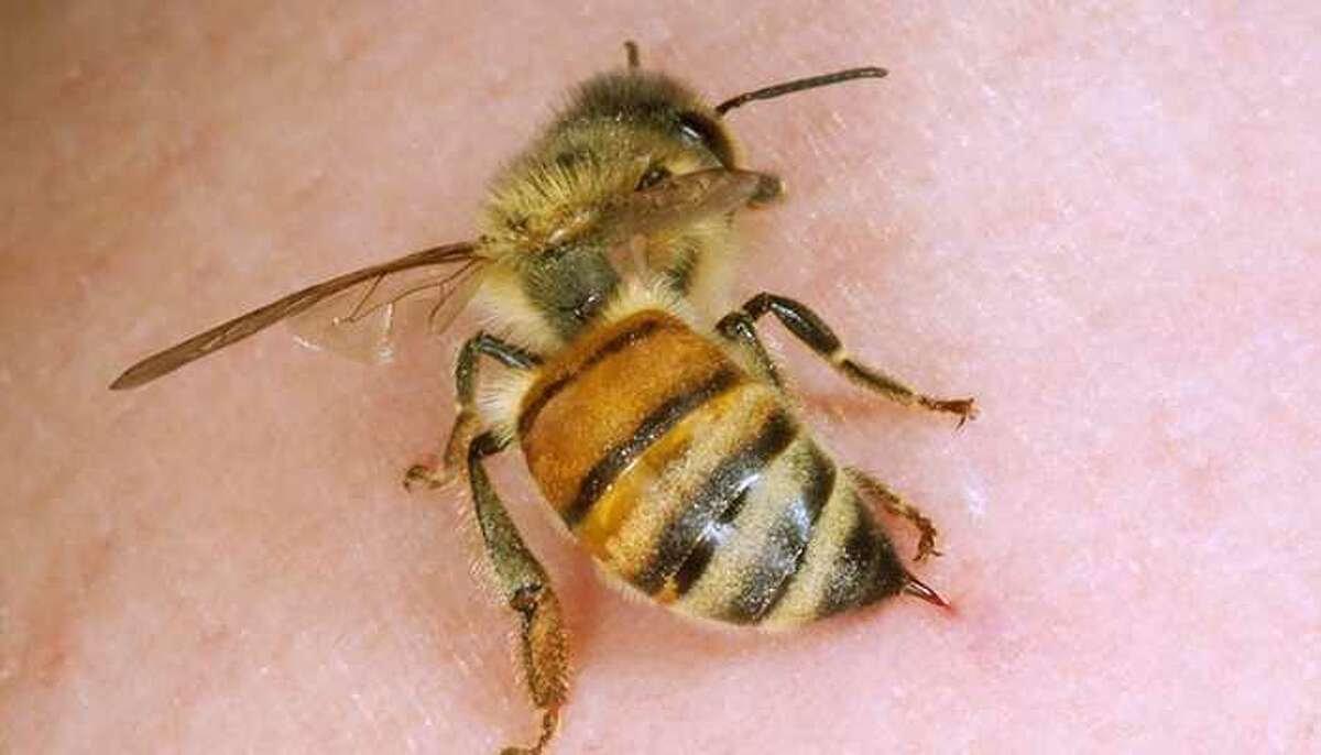 This is how to safely treat a bee sting