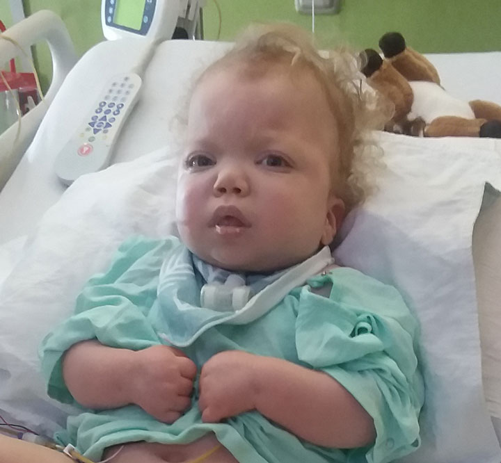 Milford rallies around toddler born with airway disorder