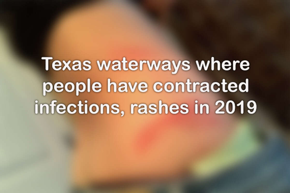Texas waterways where people have contracted infections, rashes in 2019