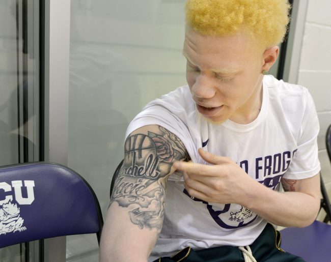 TCU athlete with albinism embraces his life, appearance
