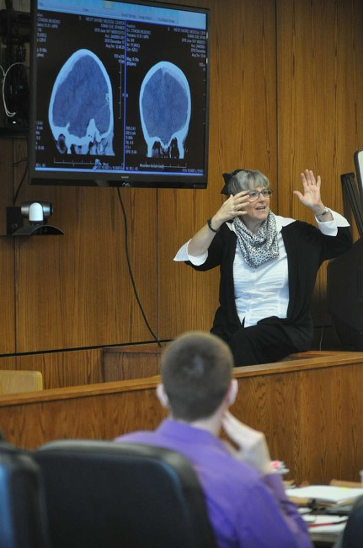 Medical professionals outline child abuse diagnosis