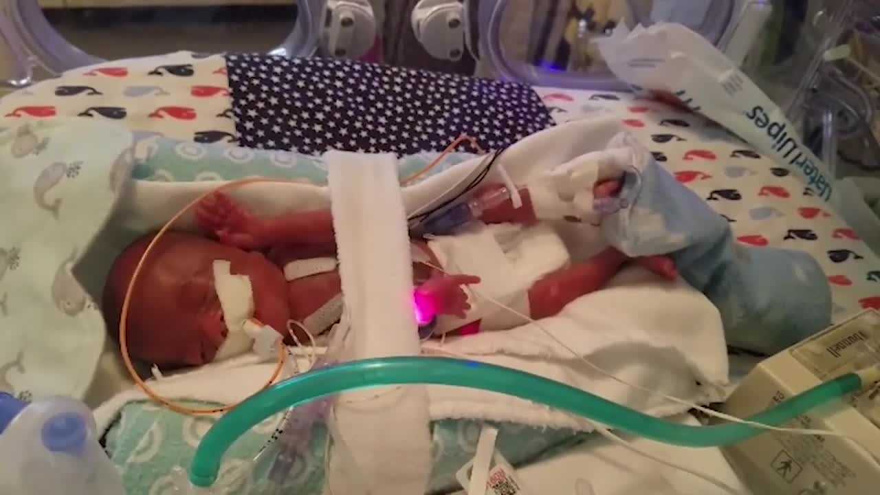 Family confirms death of miracle baby born weighing 13 oz.