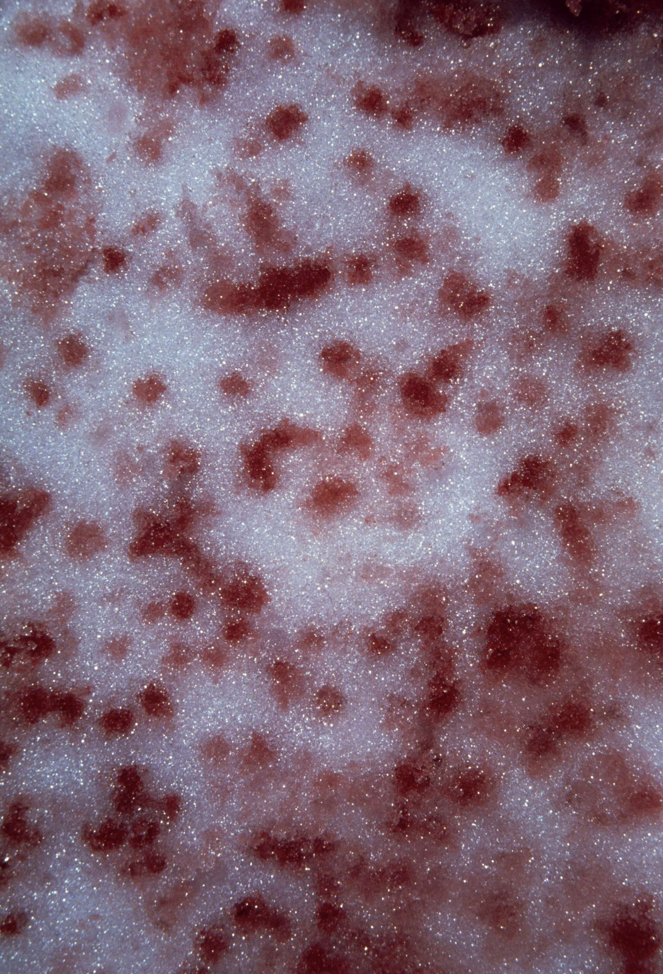 Pink 'watermelon snow' found in Yosemite's high country