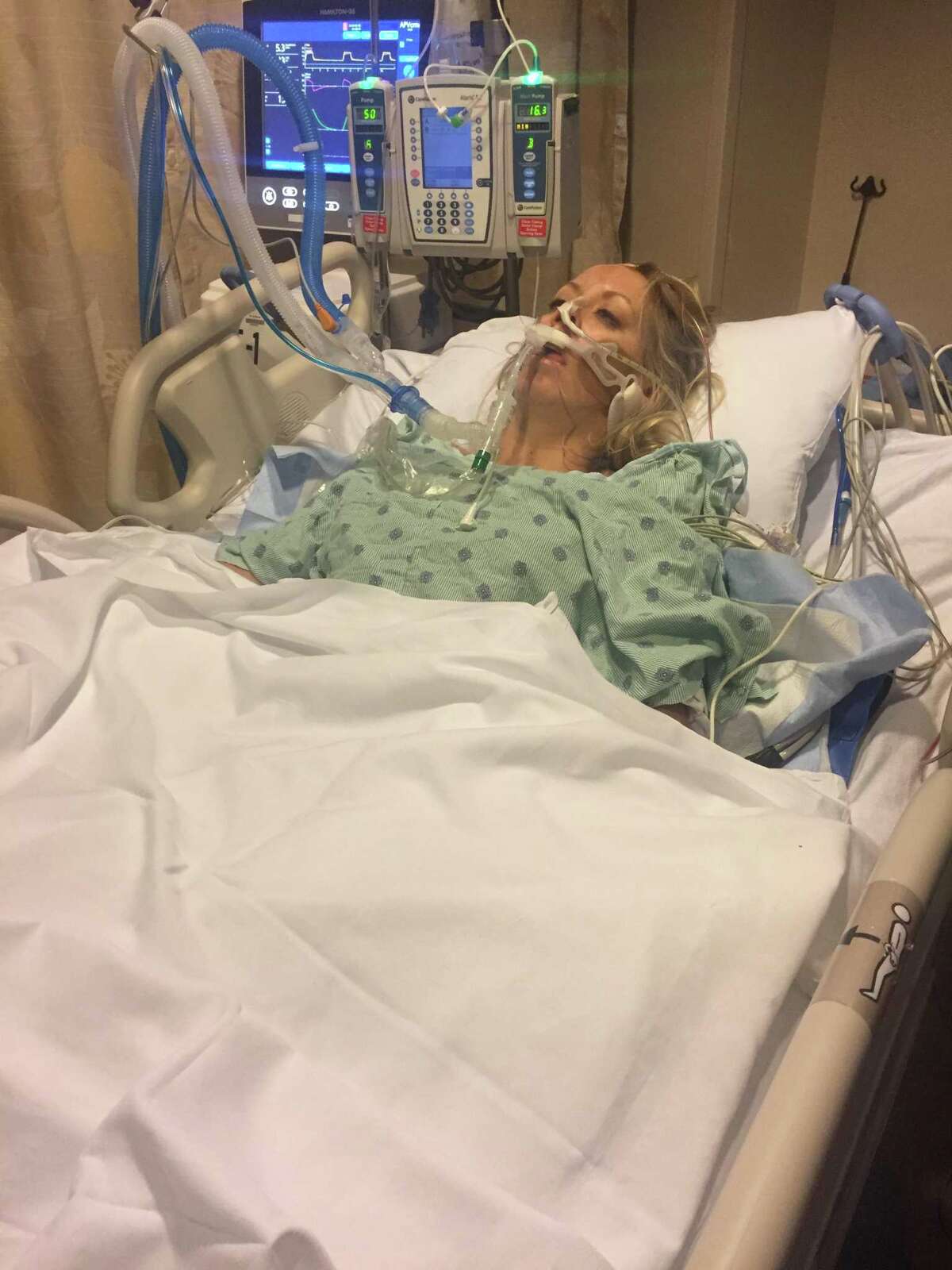 Women are almost twice as likely to develop brain aneurysms than men. Doctors don’t know why.