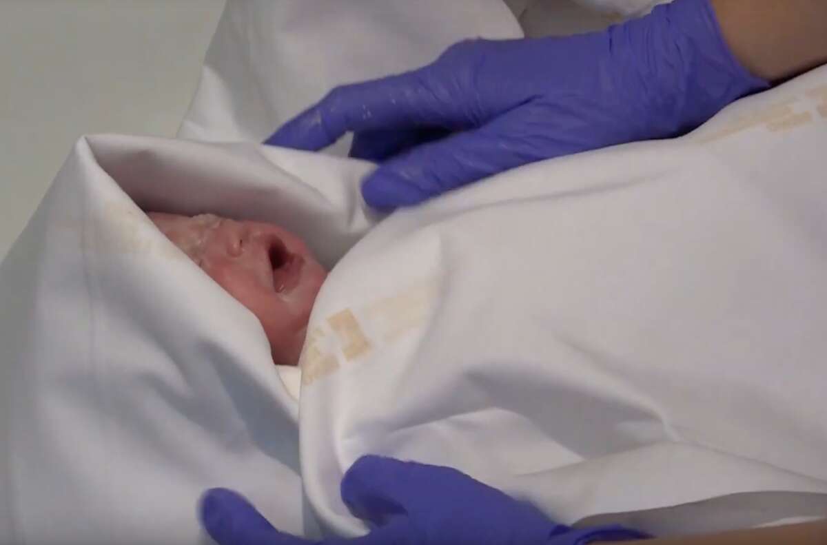 Woman gives birth to healthy baby girl after being brain dead for ...
