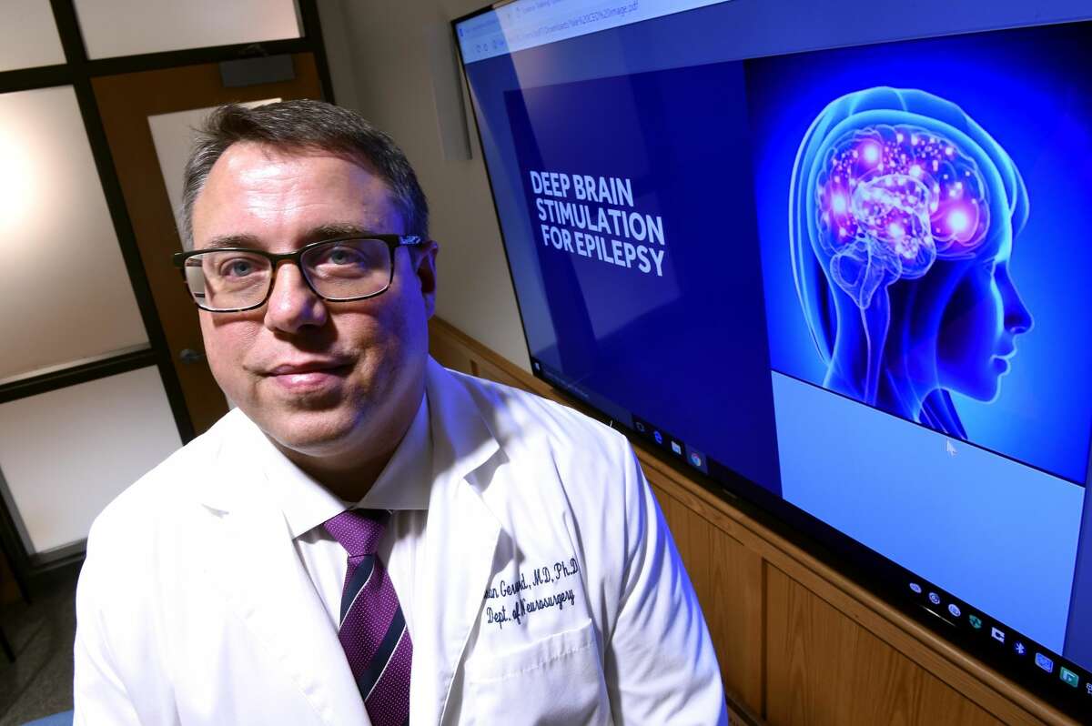 New surgery treats epilepsy with deep-brain stimulation