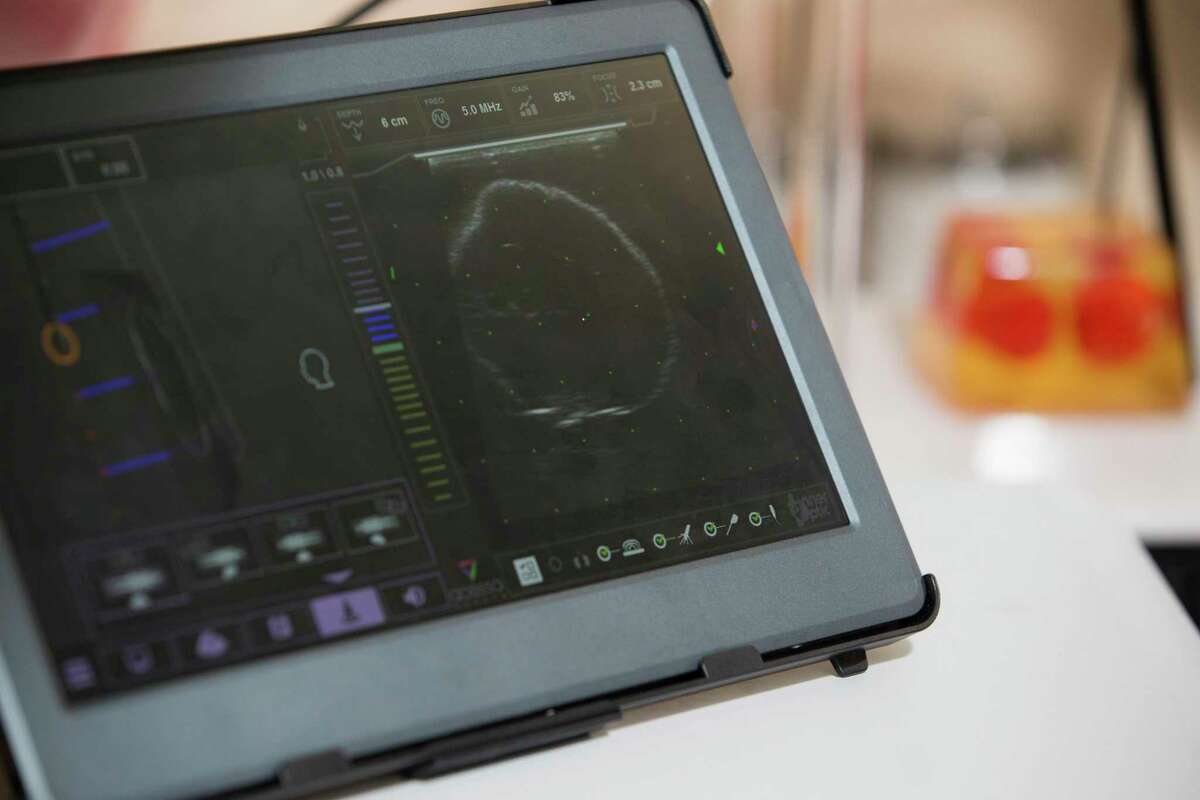 Minimally invasive solution for fibroids helps Houston trainer get back ...