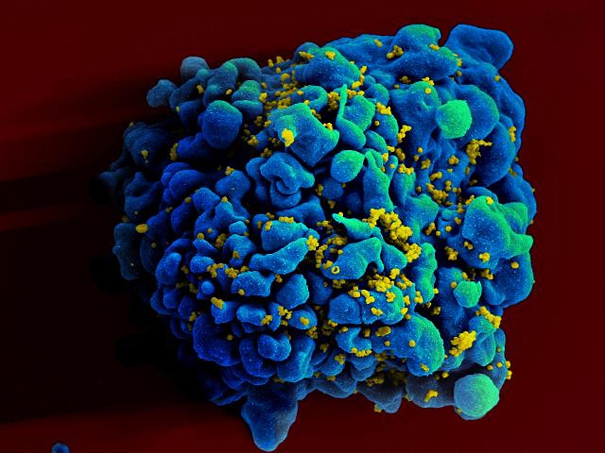 New HIV drug ‘highly effective’ at preventing infection, study shows