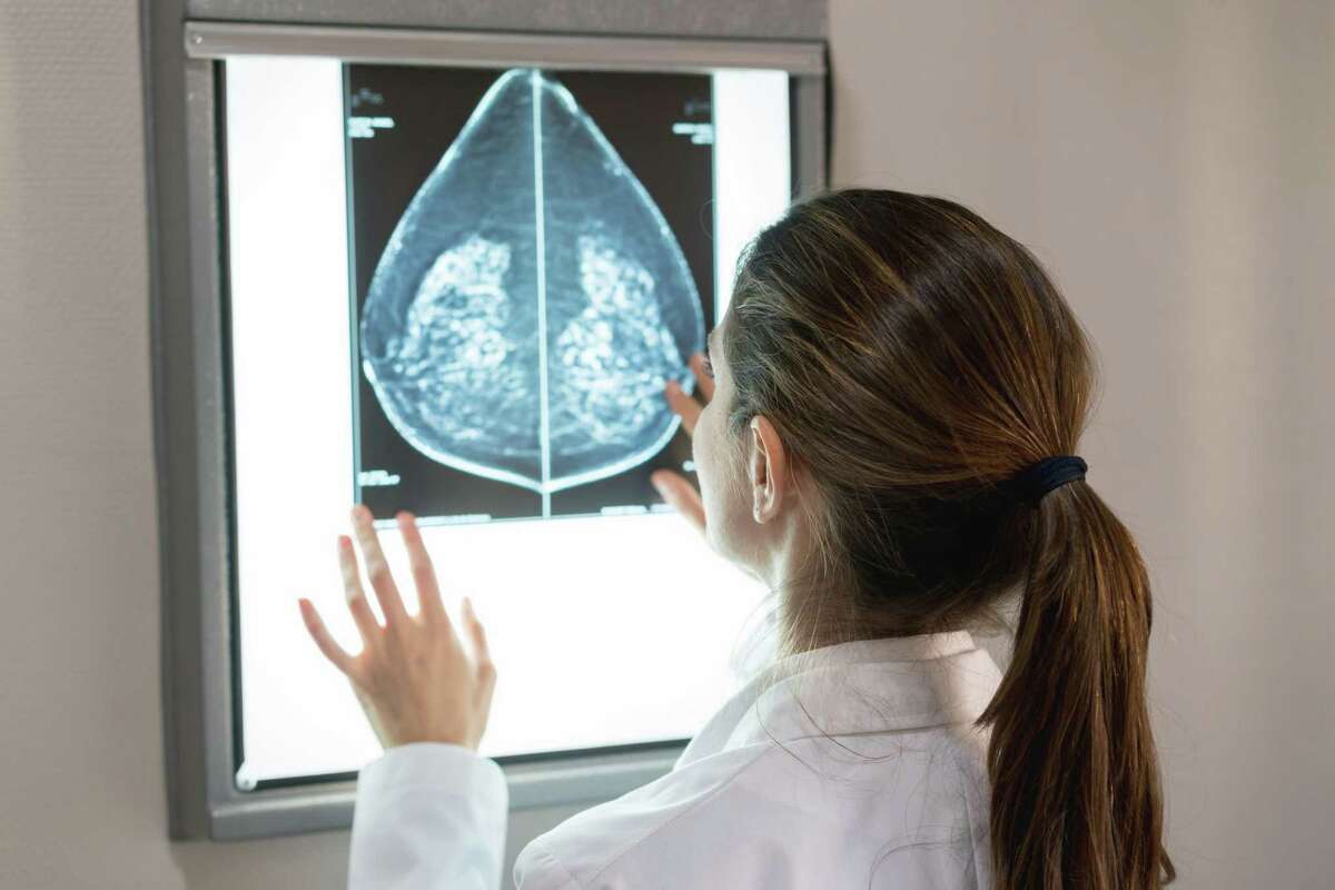 What is a mammogram? 5 things you may not know