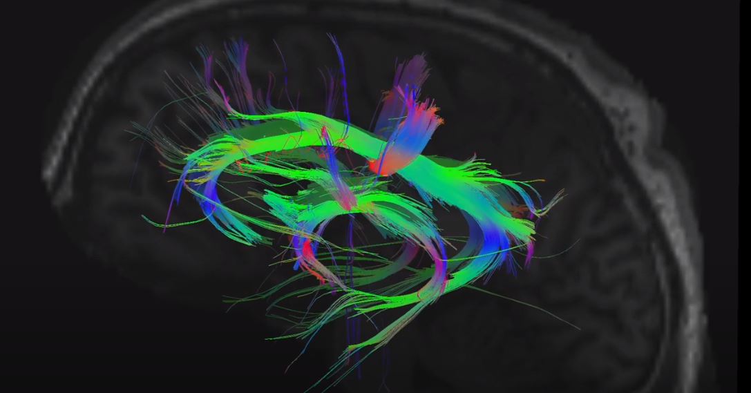 GE Research developing new MRI tech to detect brain injuries