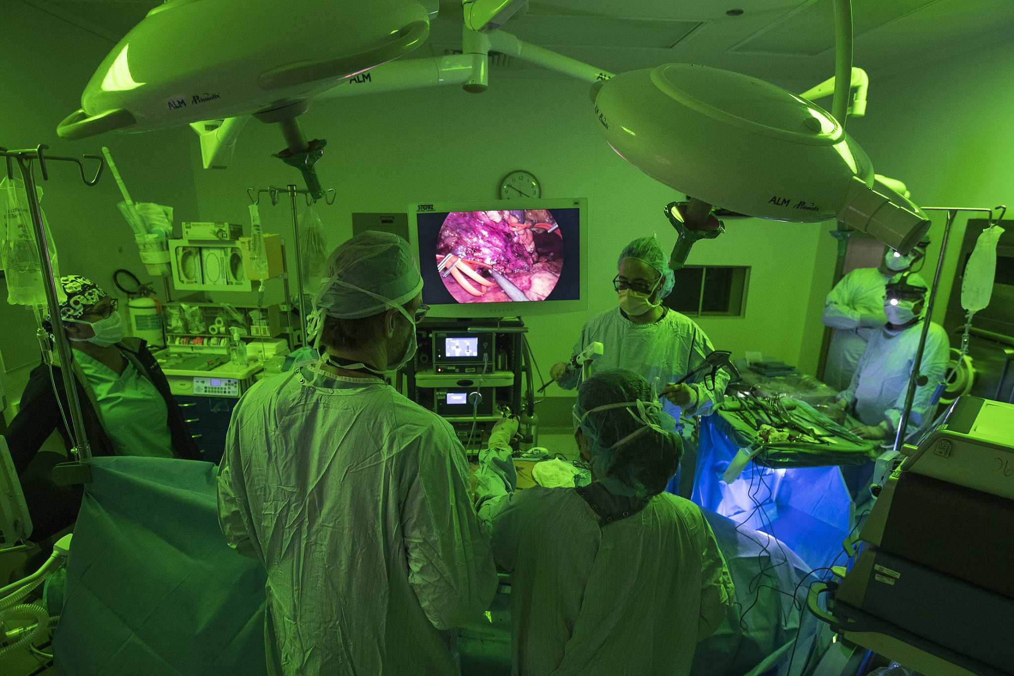 Magnolia couple saves 5 lives with Houston Methodist kidney swap