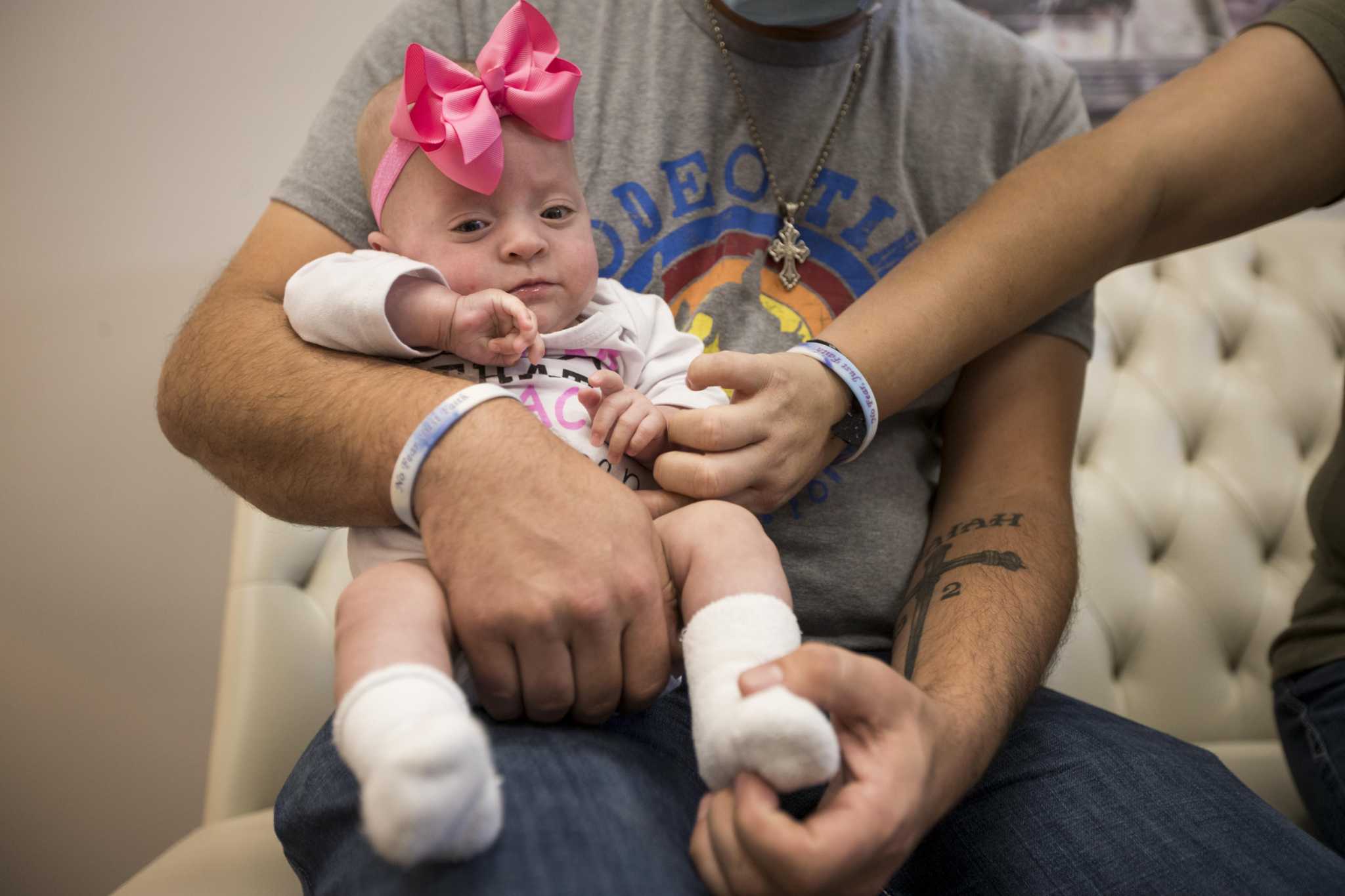 At birth, Dallie was the size of her mother’s hand. Now she’s thriving.