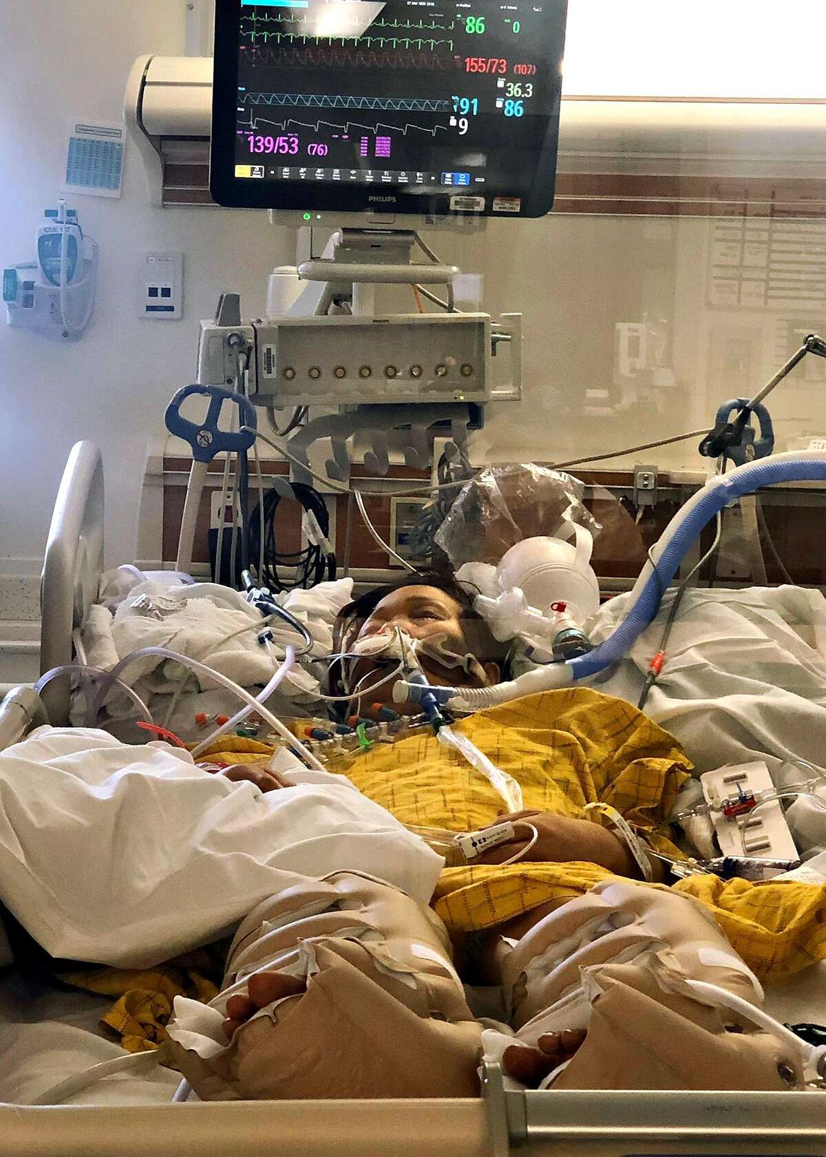 ‘God spared my life. Why?’ Bay Area family hit hard by COVID-19 mourns loss