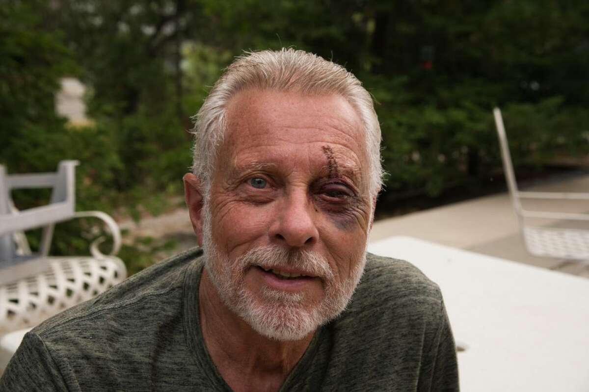 How I survived a bear attack in California's Trinity Alps