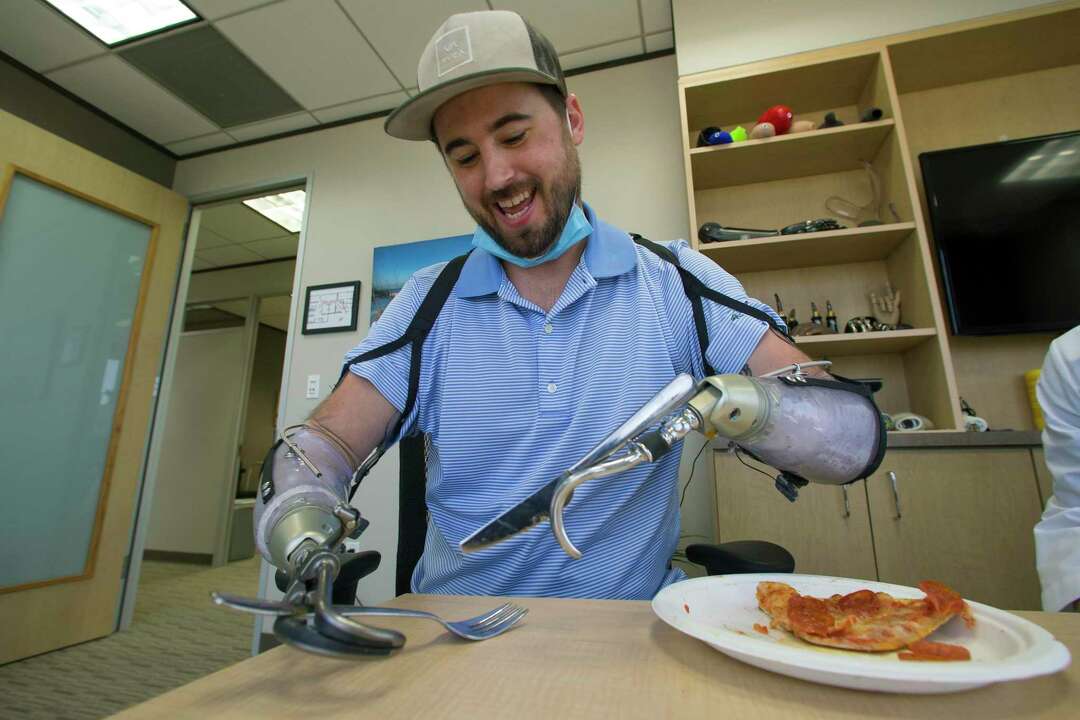 He had both hands amputated after an industrial accident. Now he's ...