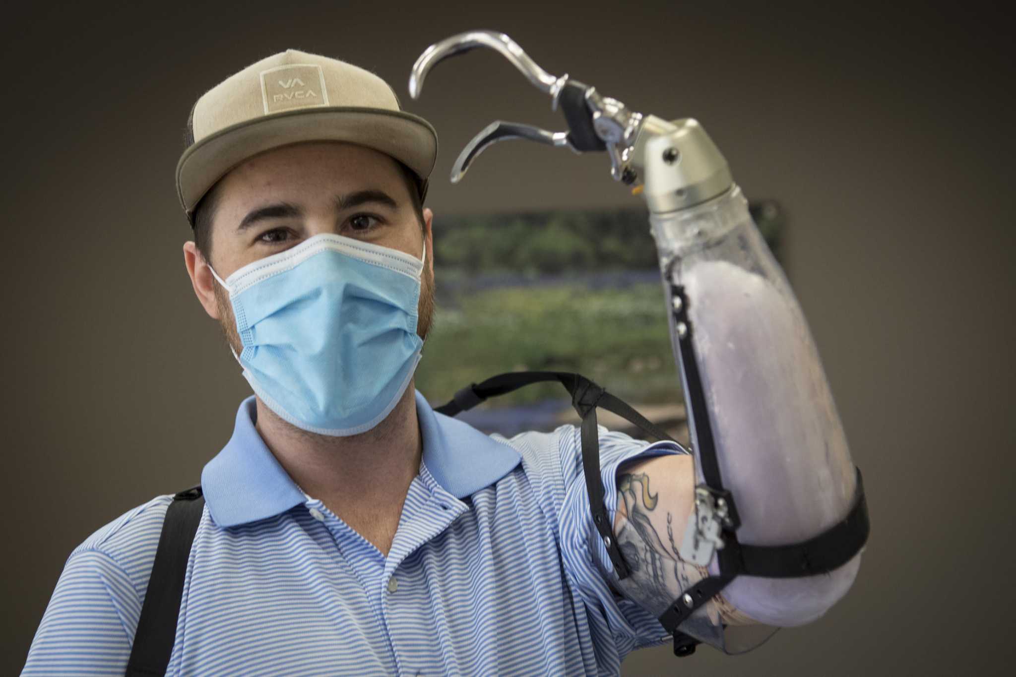 He had both hands amputated after an industrial accident. Now he's ...