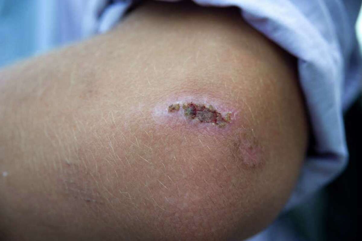 Angela Carella: Reseat city's pride in Boyle Stadium