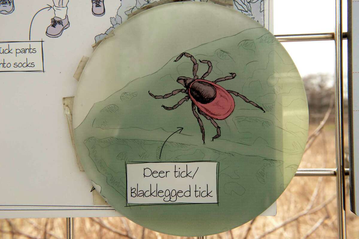 Columbia County resident may have tick-borne Powassan virus