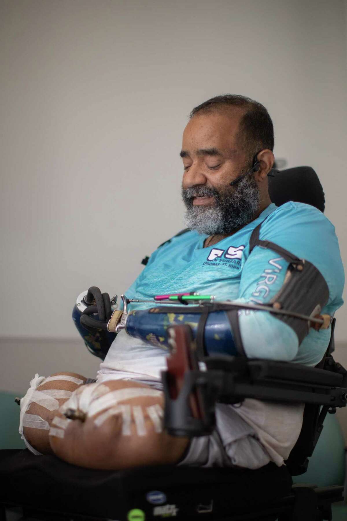 Rare procedure gives quadruple amputee a future with pain-free prosthetics