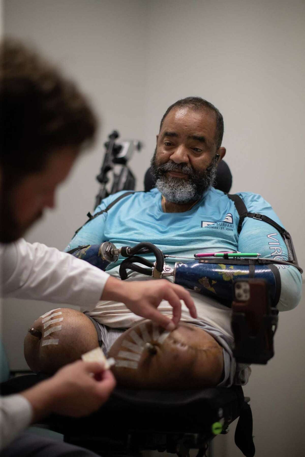 Rare procedure gives quadruple amputee a future with pain-free prosthetics