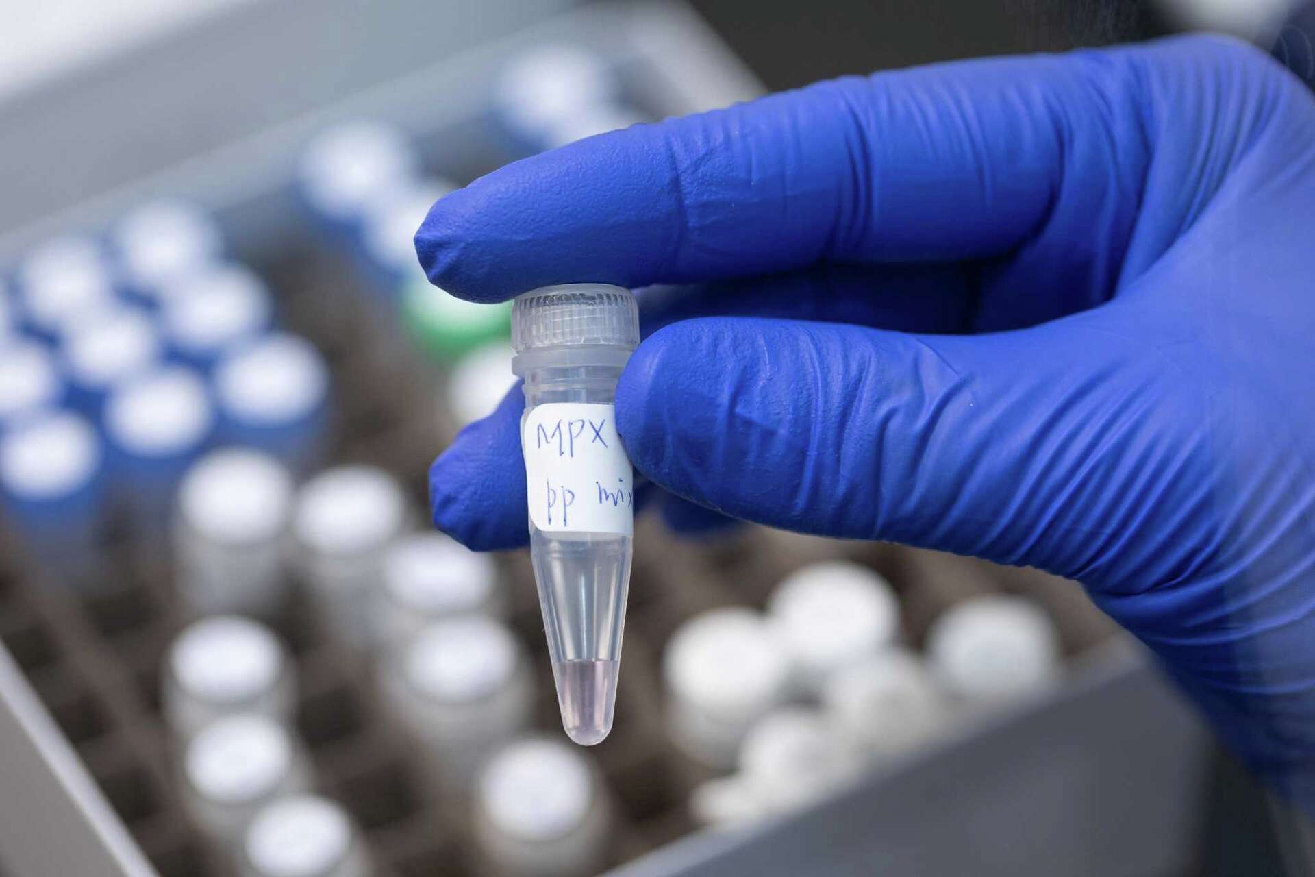 Monkeypox cases more than double in California and the Bay Area