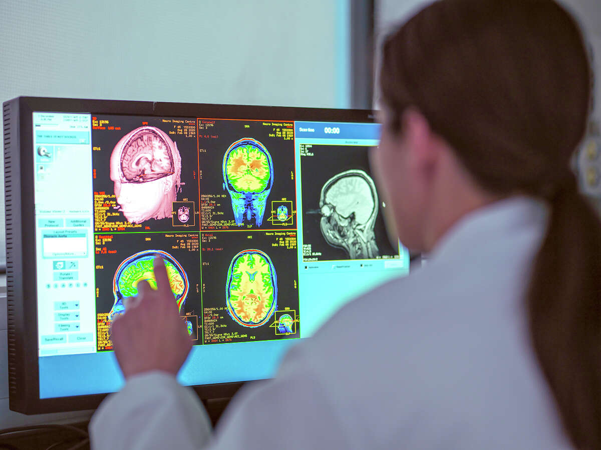 Technology: Brain stimulation can rewire, heal damage | Journal-Courier