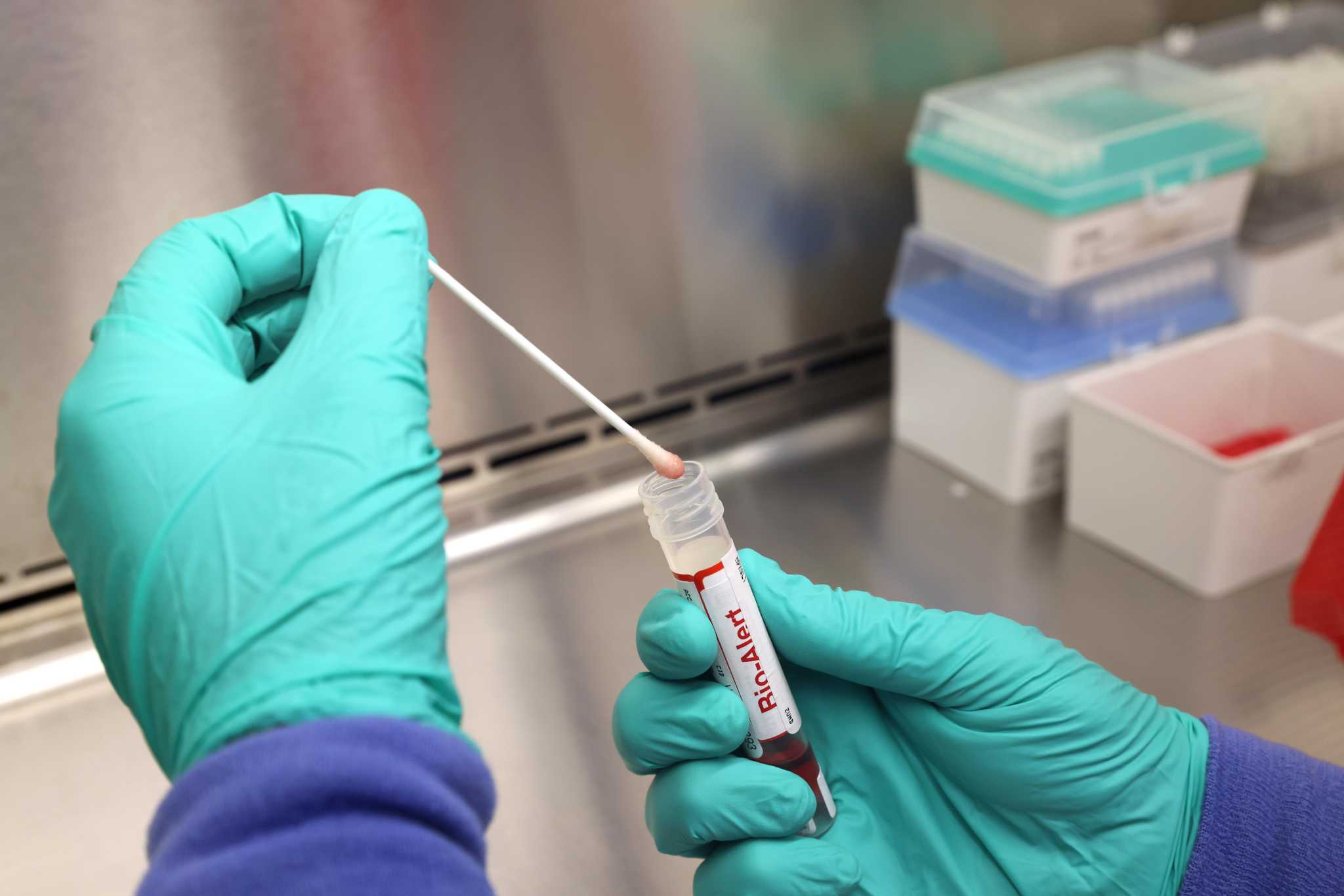 Connecticut has 11 monkeypox cases, health department says