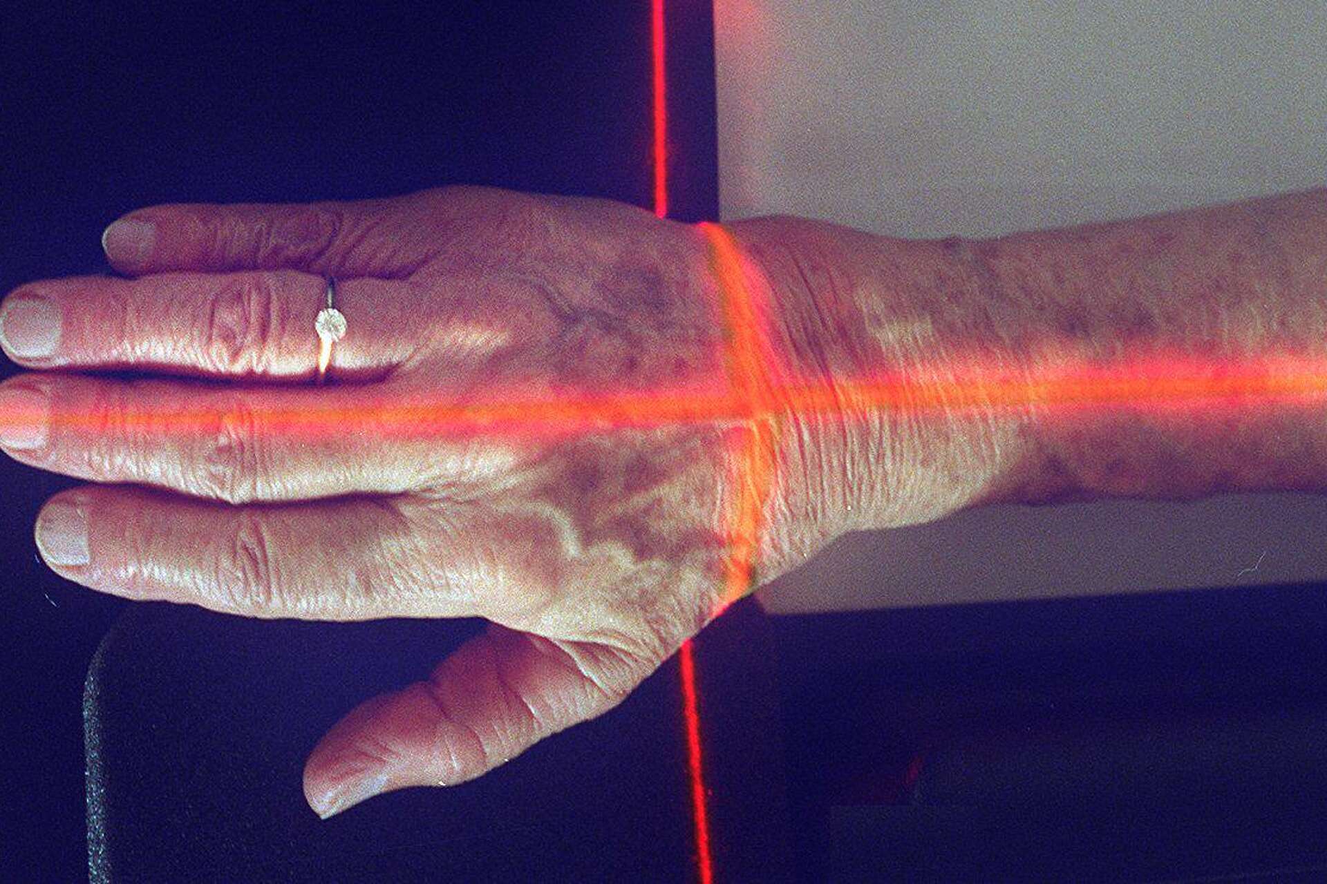 Getting to the root of bone density issues