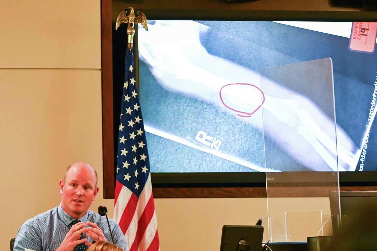 Witness at mom’s murder trial sat with S.A. girl on life support