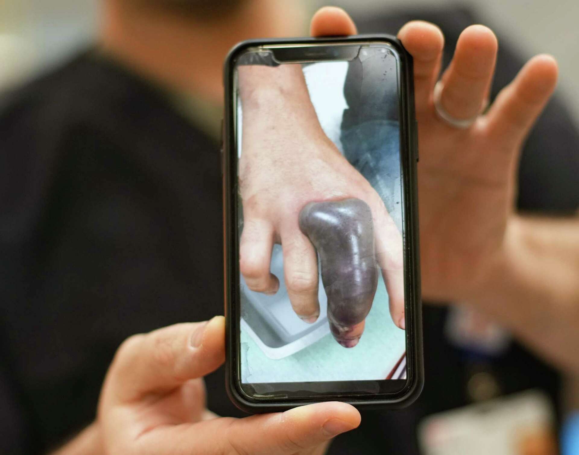 Kingwood hospital treats most snakebites in the nation