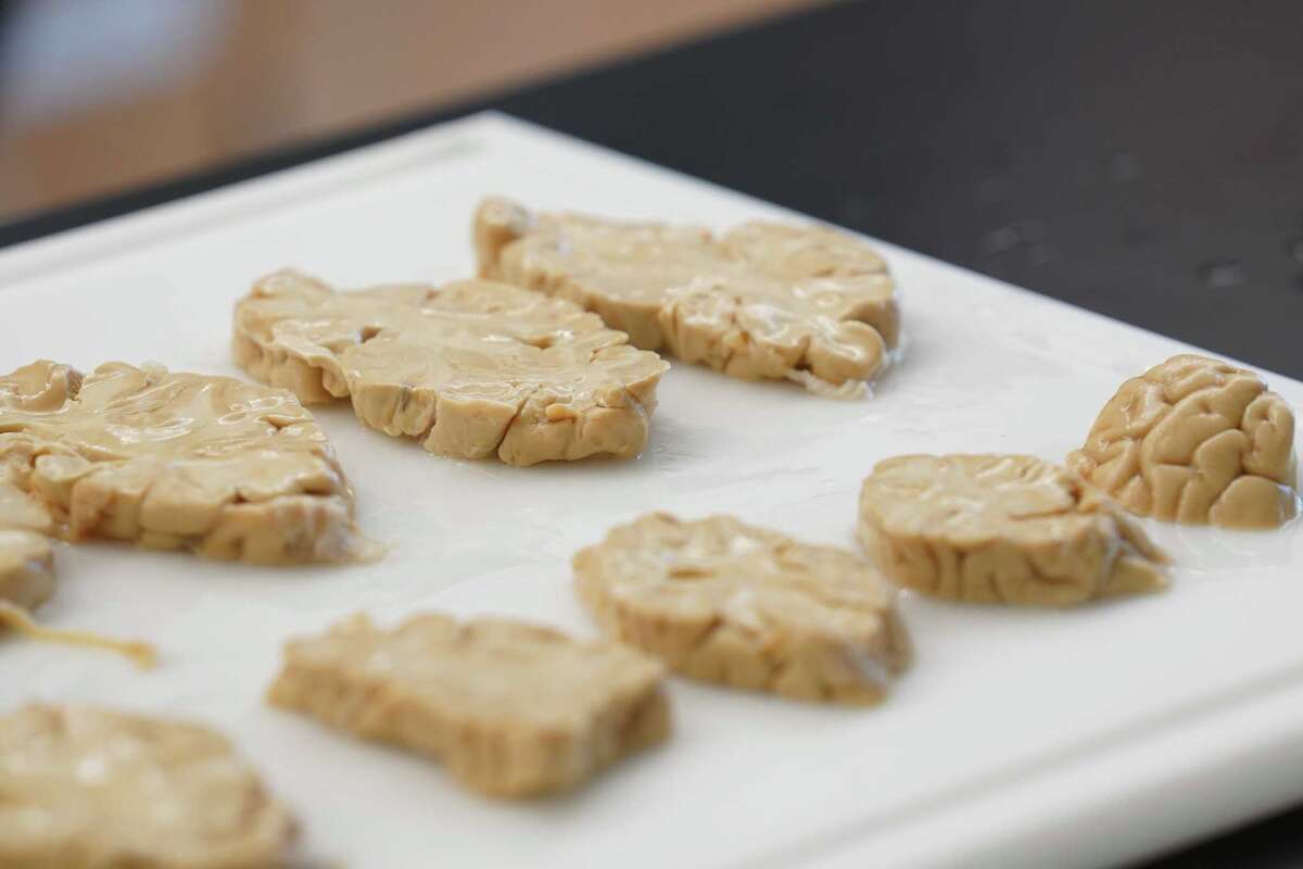 Researchers investigate drug addiction at Houston brain bank