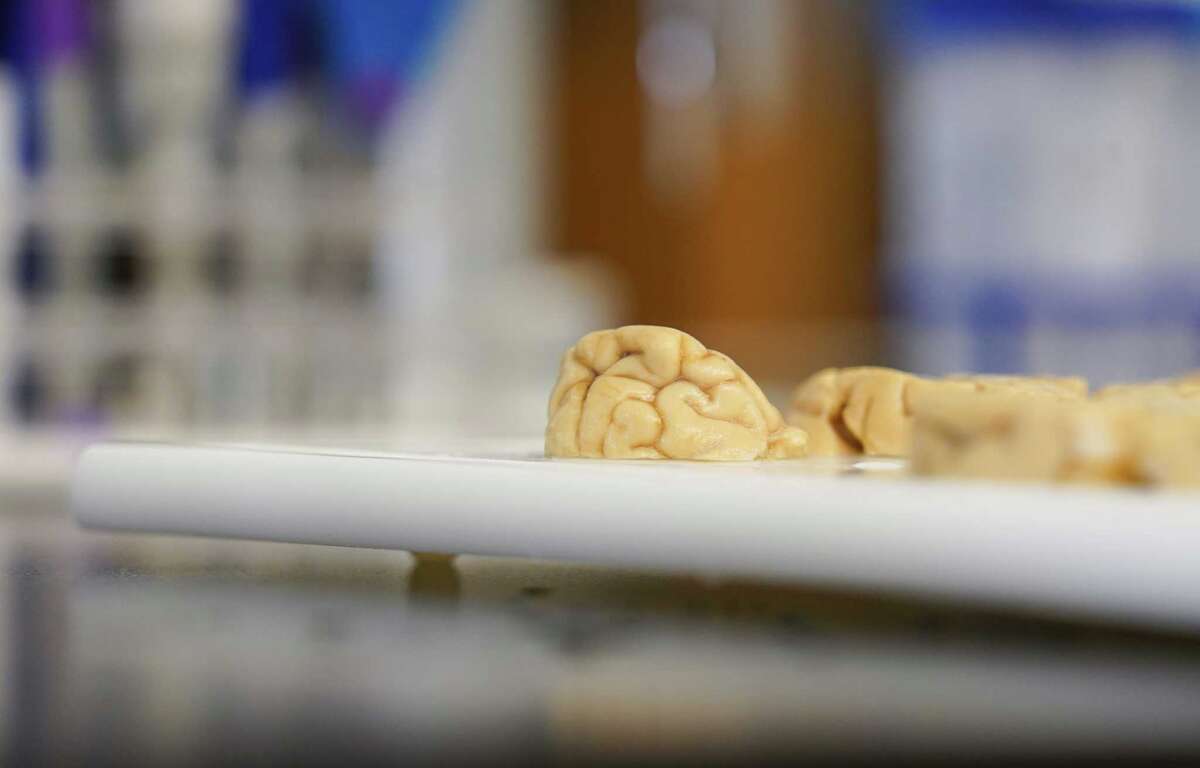 Researchers investigate drug addiction at Houston brain bank