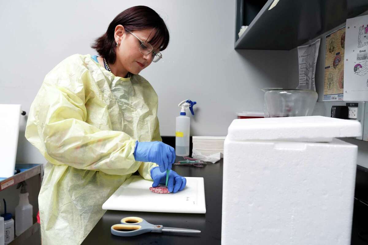 Researchers investigate drug addiction at Houston brain bank