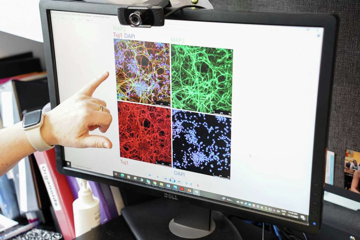 Researchers investigate drug addiction at Houston brain bank