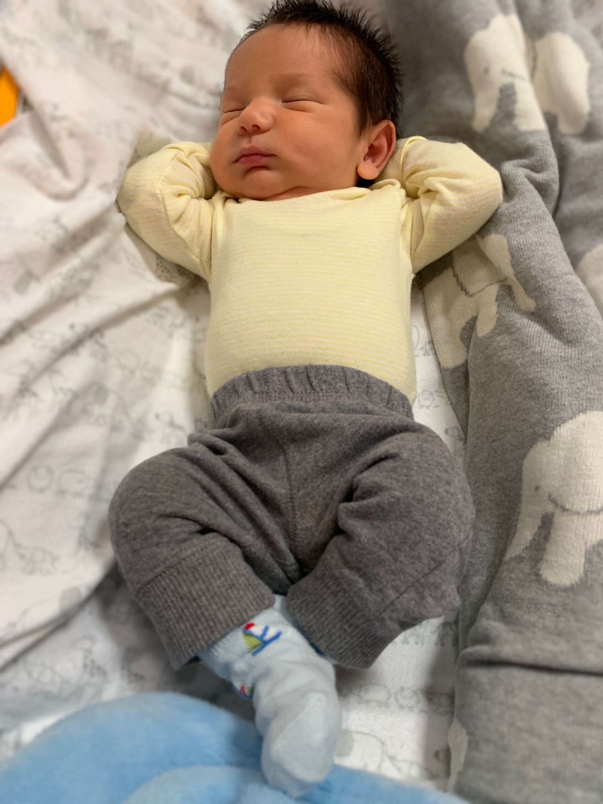 Baby had days to live before heart surgery at Texas Children's