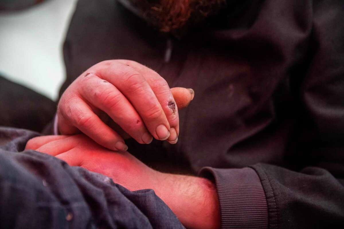 New drug ‘tranq’ could make SF's fentanyl crisis even worse