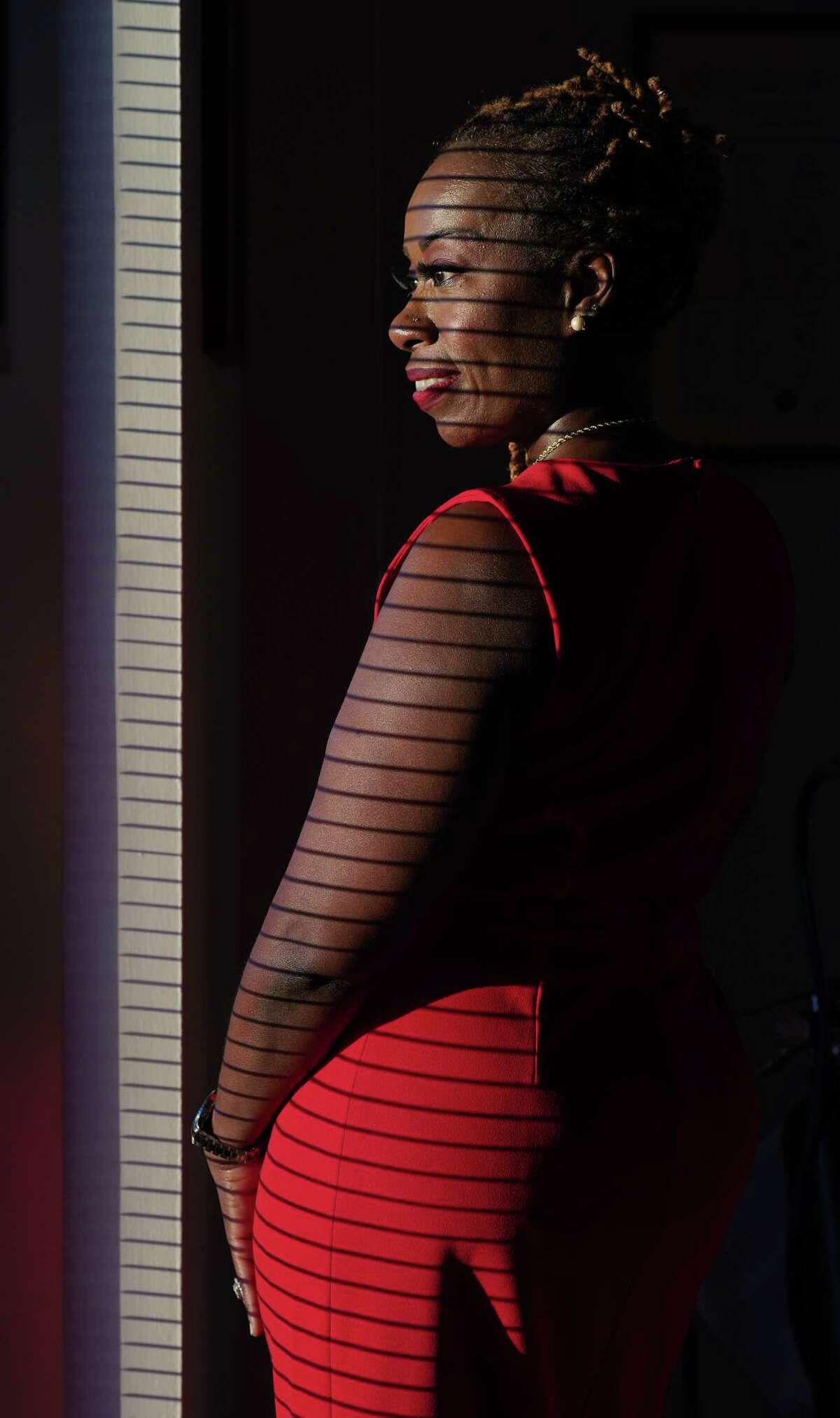 Fat grafting is booming as plastic surgery trends are evolving