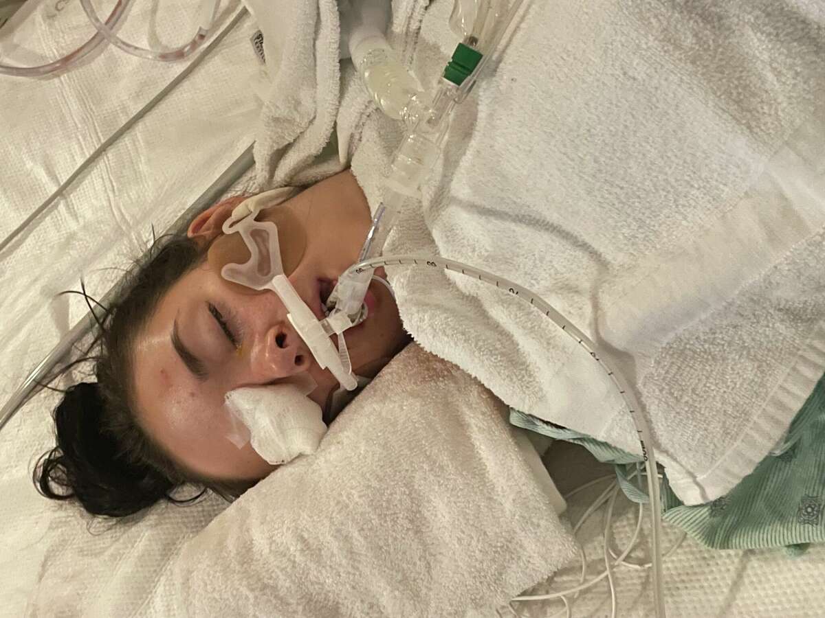 Texas cheerleader's traumatic brain injury and road to recovery