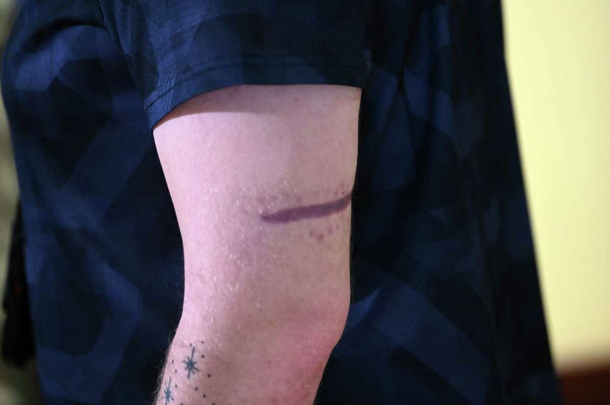 Randell Mason admits sword attack against Jon Romano